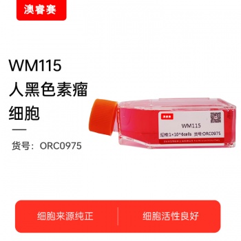 人黑色素瘤细胞;WM115_人源细胞系_细胞系_澳睿赛生物技术（上海）有限公司 - 专业细胞生物学供应商